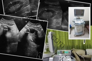 Ultrasonography (USG) Urology: Pemeriksaan Simpel untuk Deteksi Dini ...