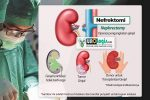 Nefrektomi (Nephrectomy): Operasi Pengangkatan Ginjal - urologis.com