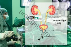 Ureteroskopi (Ureteroscopy/URS): Prosedur Minimal Invasif Efektif untuk ...